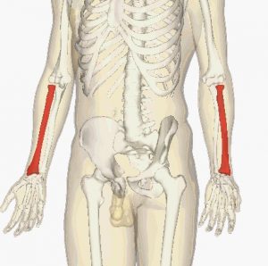Clasificación de Frykman - ¿Cómo se clasifican?