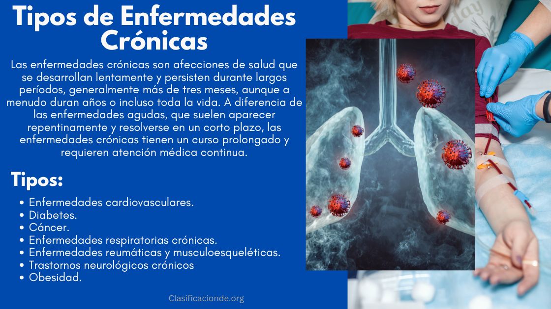 Tipos de Enfermedades Crónicas - ¿Cómo se clasifican?